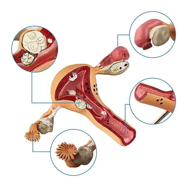Ovarian Model – IBMC EduHub