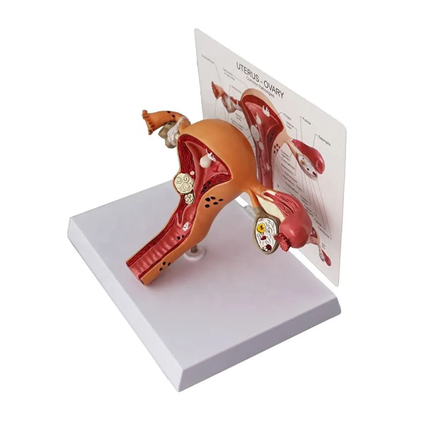 Ovarian Model – IBMC EduHub
